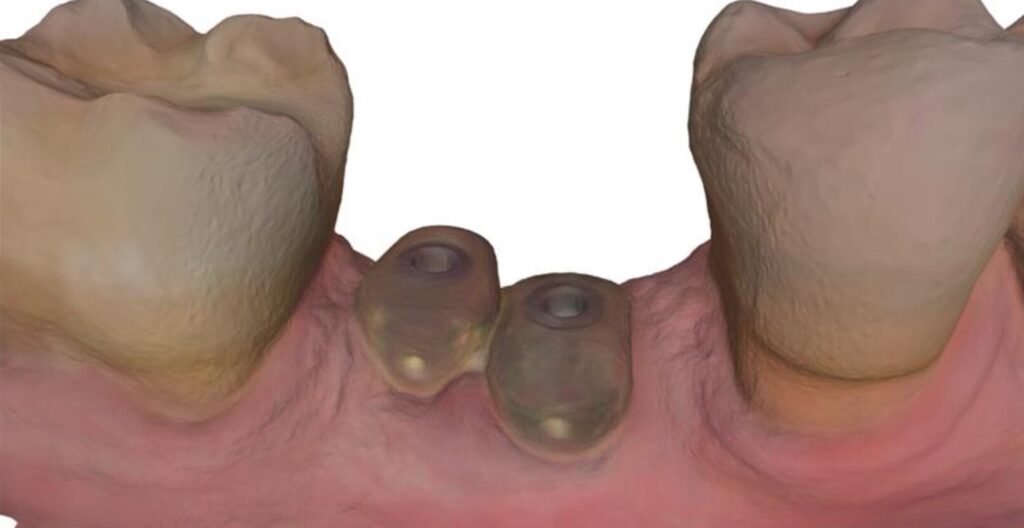 Tutorials and best practices in the practice - iPhysio®